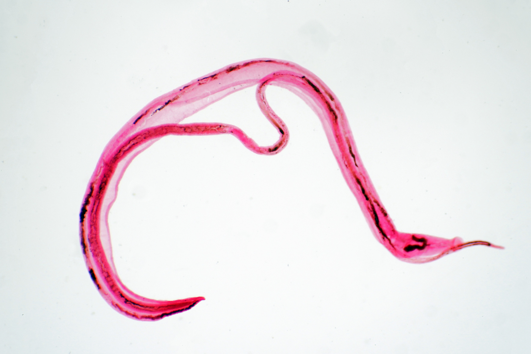 Im lepiej poznamy włosogłówkę, tym łatwiej się jej pozbędziemy - Pulsar