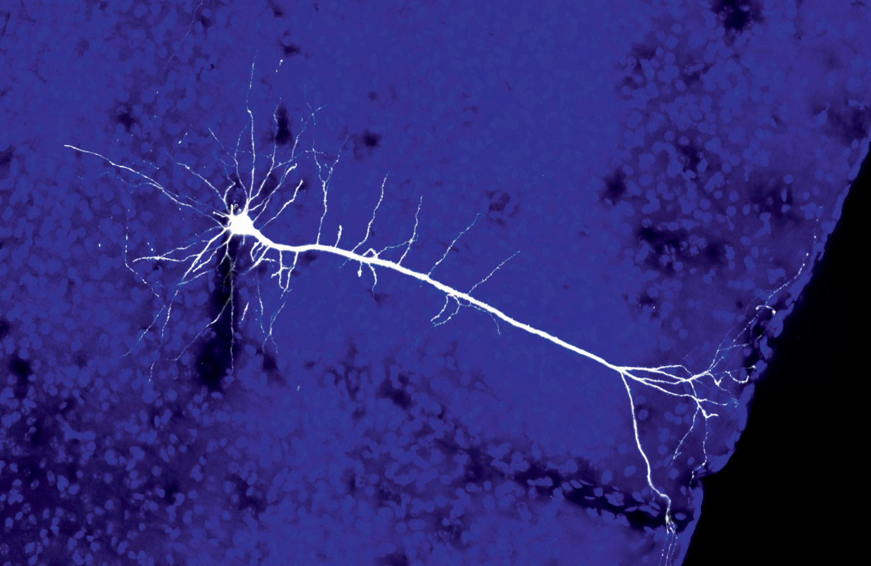 Czy kora mózgowa jest w stanie nauczyć się widzenia u osób niewidomych ...