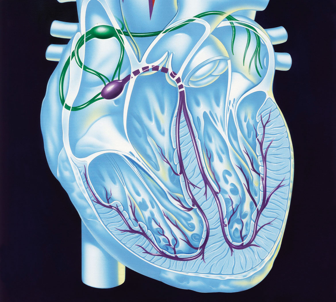 Elektryczne wspomaganie serca