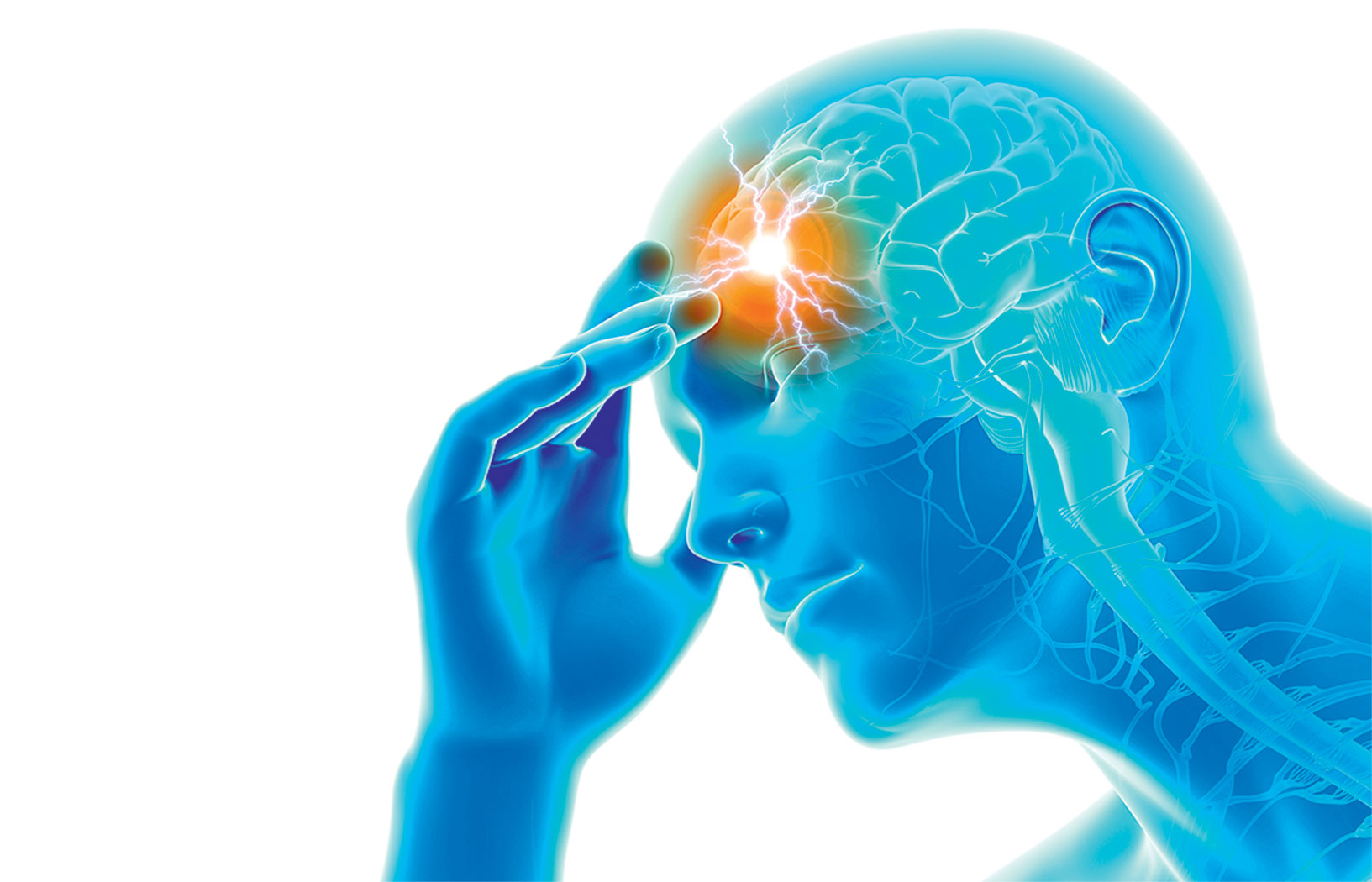 Migrena - czym jest, jak powstaje, jak ją leczyć. Czynniki wywołujące ...